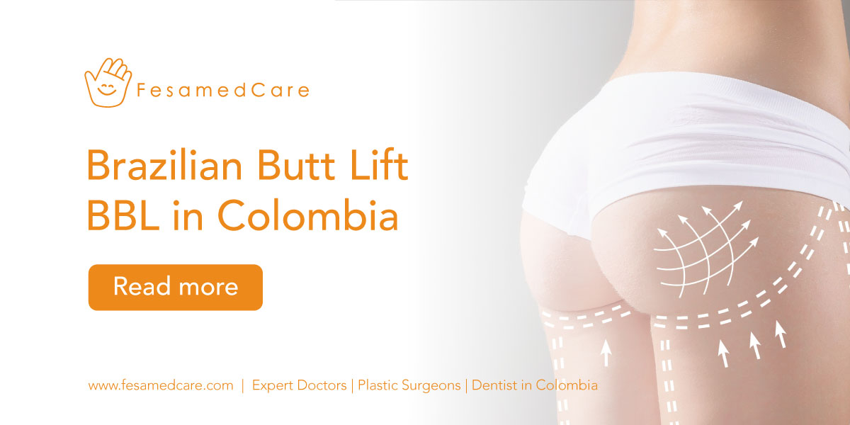 How Much Is A Bbl In Colombia